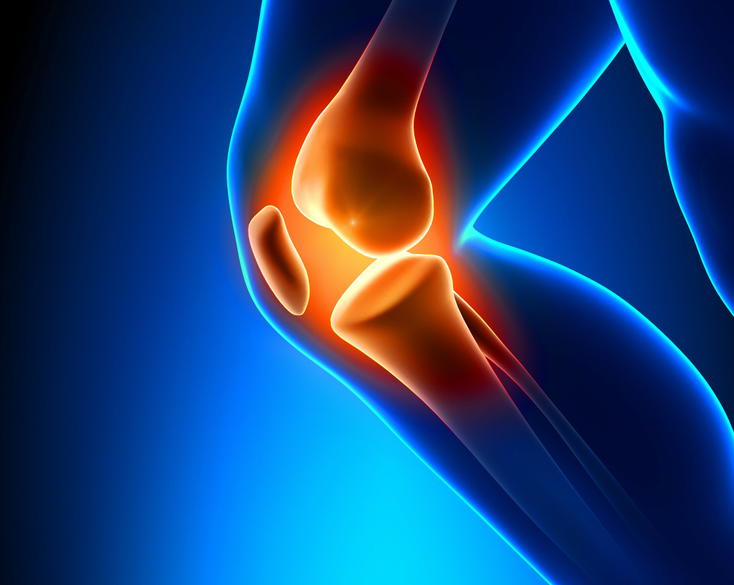 Meniskusriss: Symptome & Therapie | Diagnoselexikon Körperwerk Südbaden ...